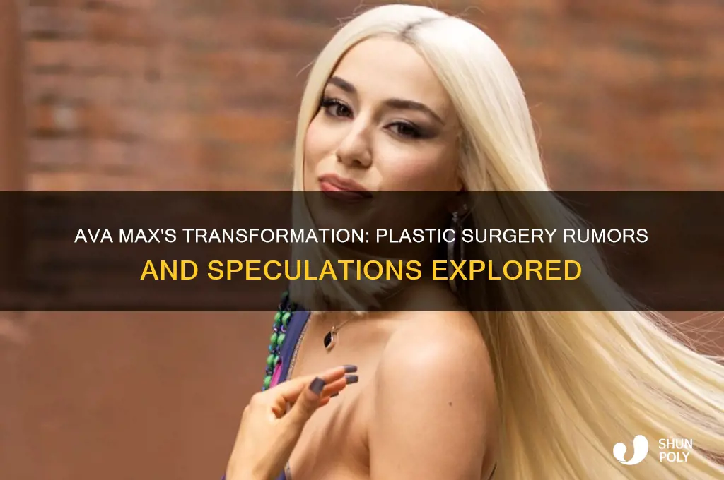 Ava Max's Transformation: Plastic Surgery Rumors And Speculations ...