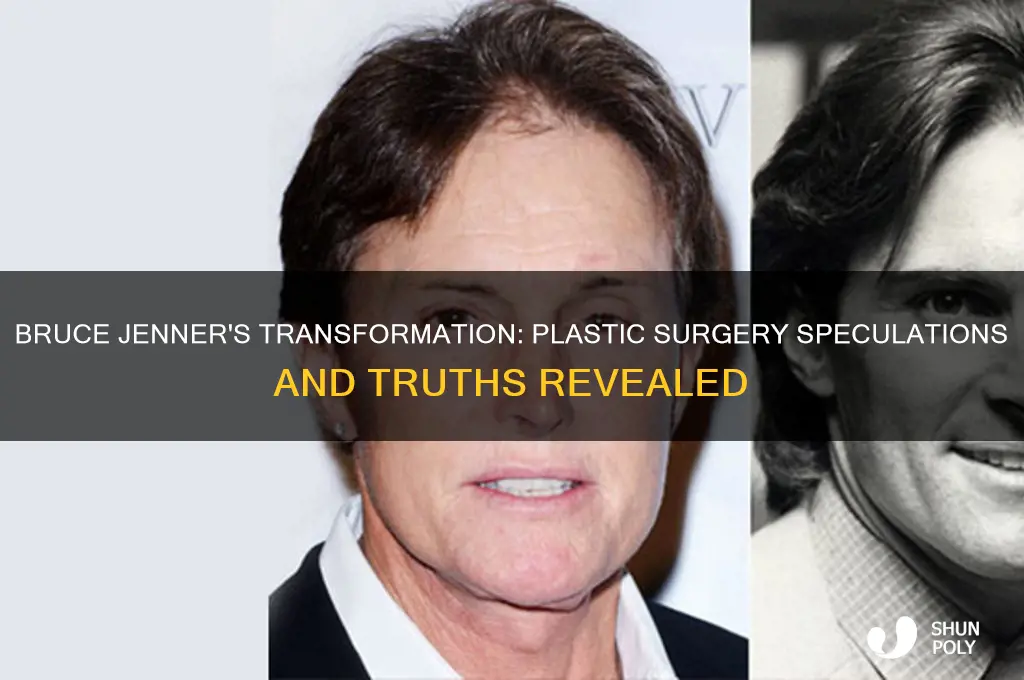 Bruce Jenner's Transformation: Plastic Surgery Speculations And Truths ...