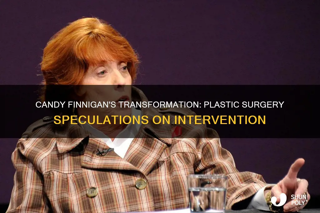 Candy Finnigan's Transformation: Plastic Surgery Speculations On ...