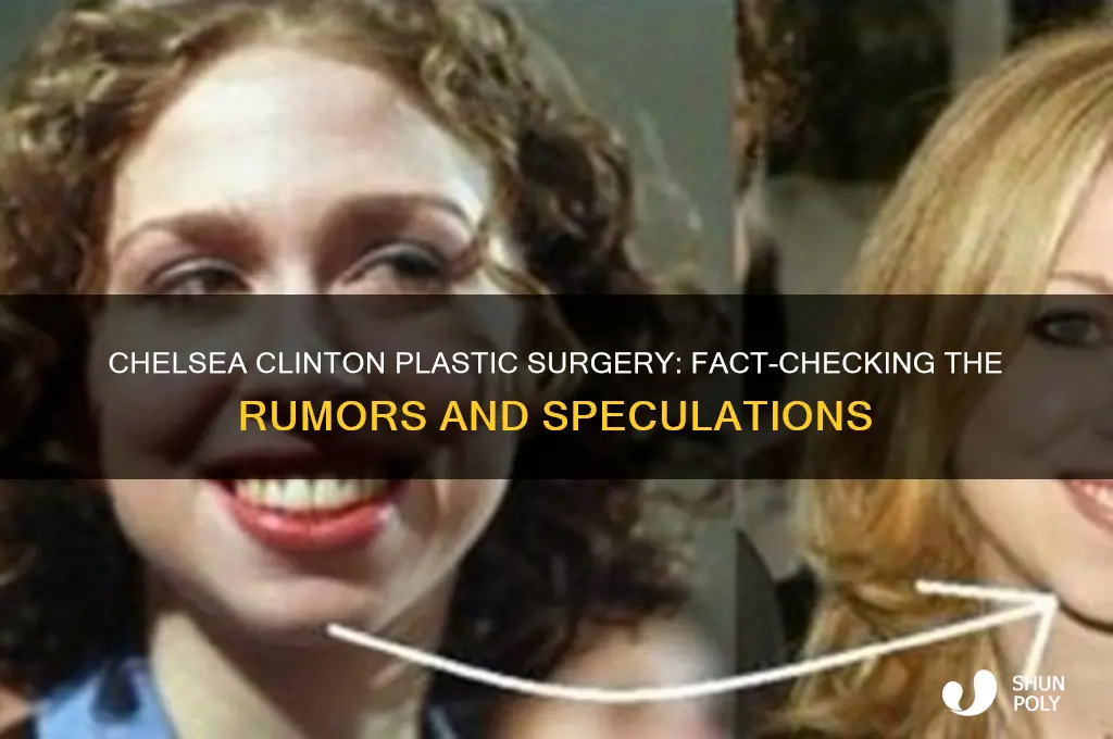 Chelsea Clinton Plastic Surgery: Fact-Checking The Rumors And ...
