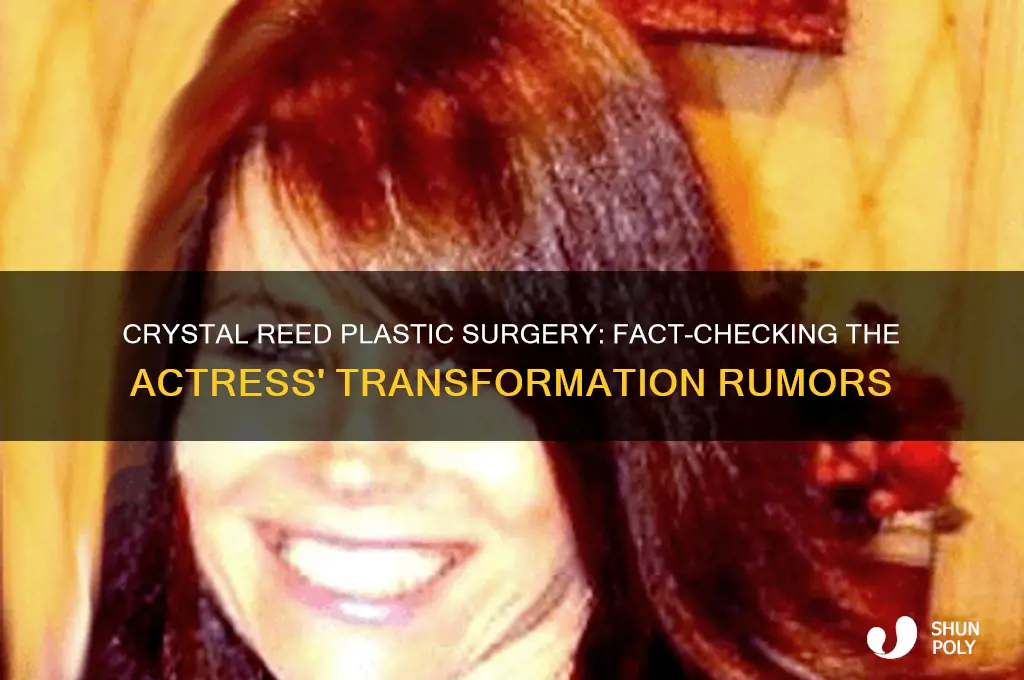 Crystal Reed Plastic Surgery: Fact-Checking The Actress' Transformation ...