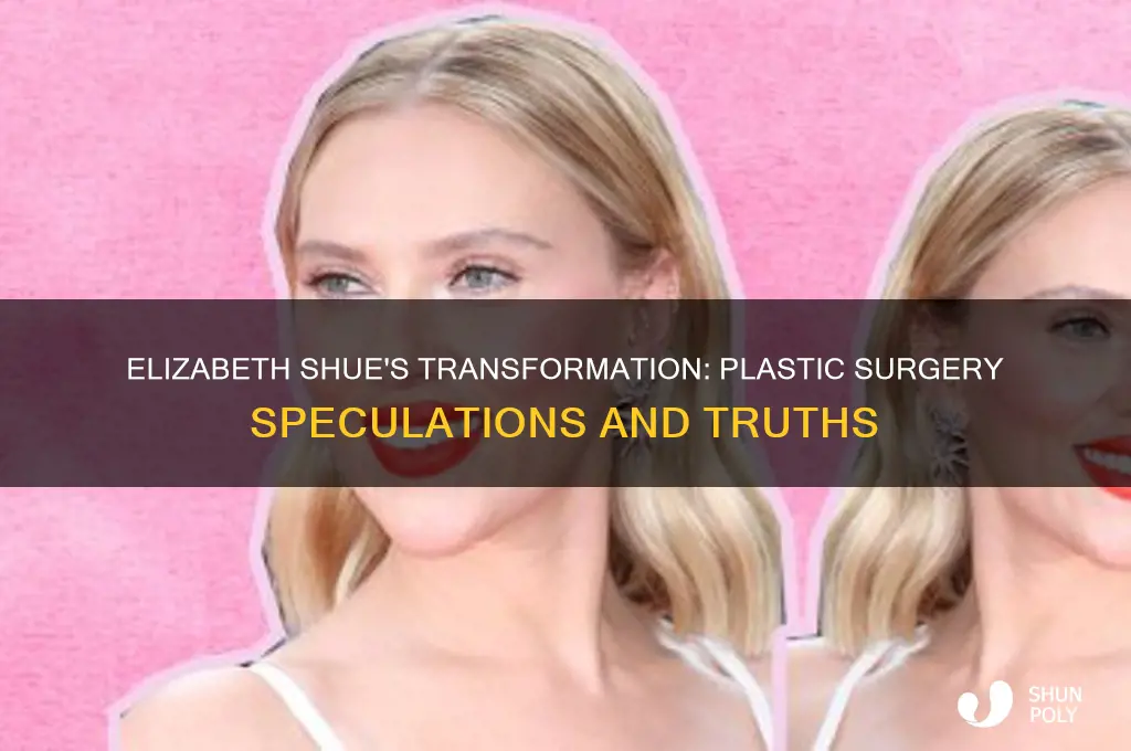 Elizabeth Shue's Transformation: Plastic Surgery Speculations And ...