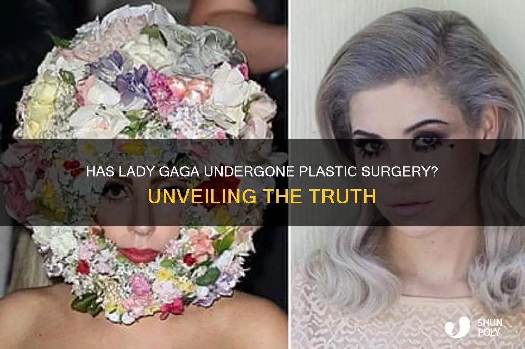 Has Lady Gaga Undergone Plastic Surgery? Unveiling The Truth | ShunPoly