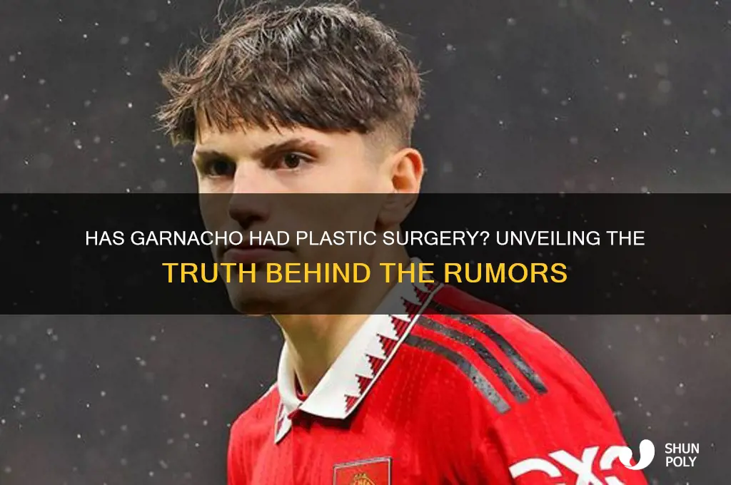 Has Garnacho Had Plastic Surgery? Unveiling The Truth Behind The Rumors ...