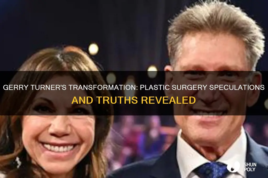 Gerry Turner's Transformation: Plastic Surgery Speculations And Truths ...