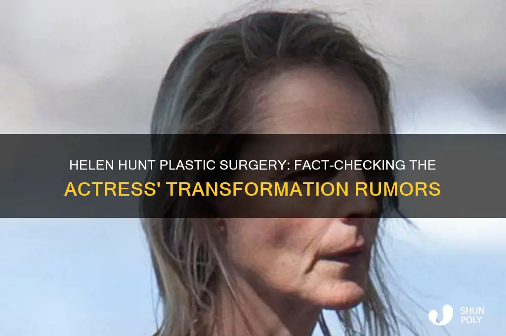 Helen Hunt Plastic Surgery: Fact-Checking The Actress' Transformation ...