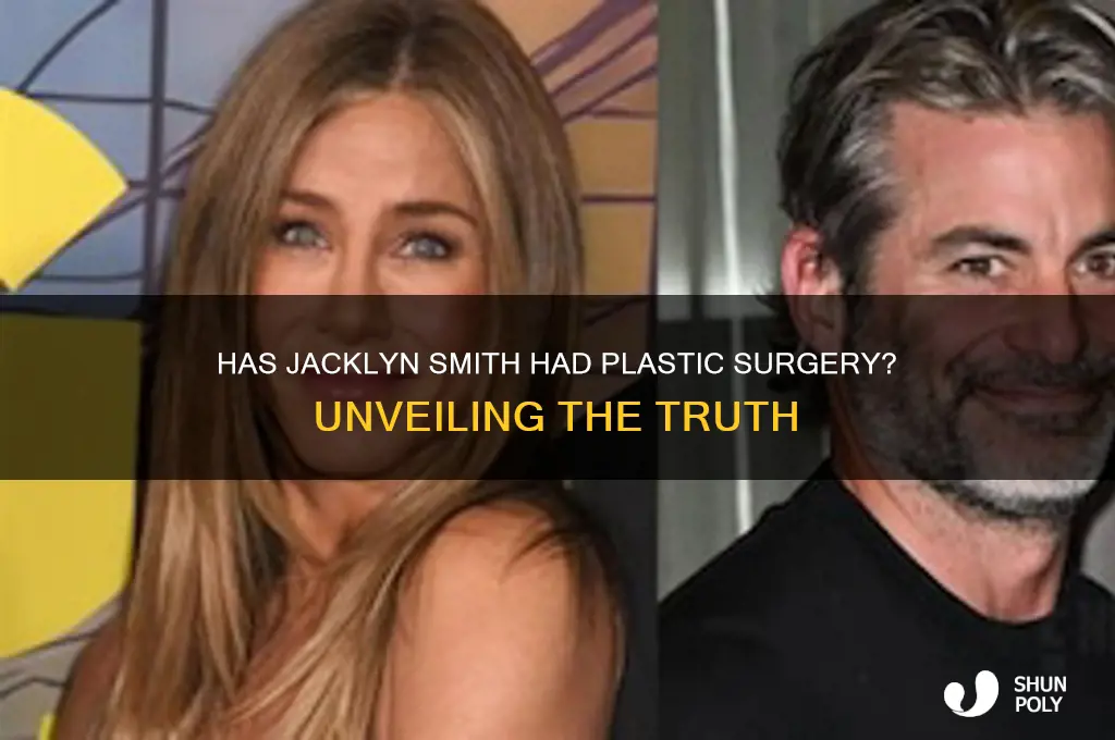 Has Jacklyn Smith Had Plastic Surgery? Unveiling The Truth | ShunPoly