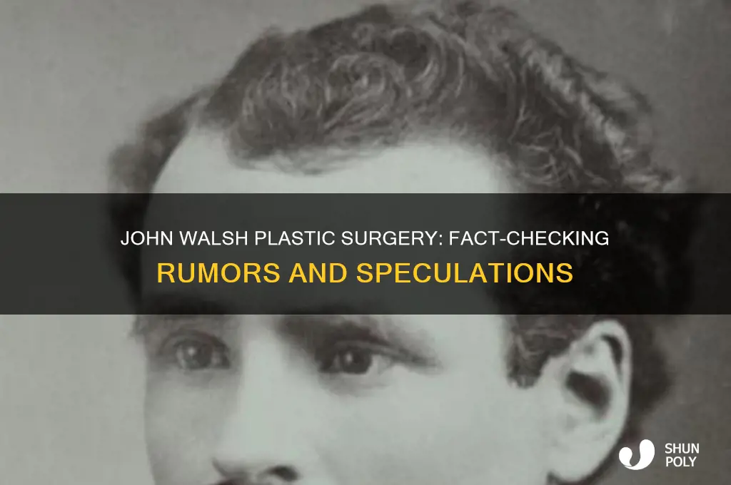 John Walsh Plastic Surgery: Fact-Checking Rumors And Speculations ...