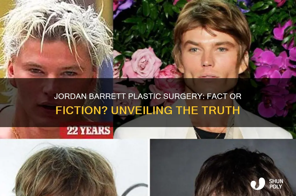 Jordan Barrett Plastic Surgery: Fact Or Fiction? Unveiling The Truth ...