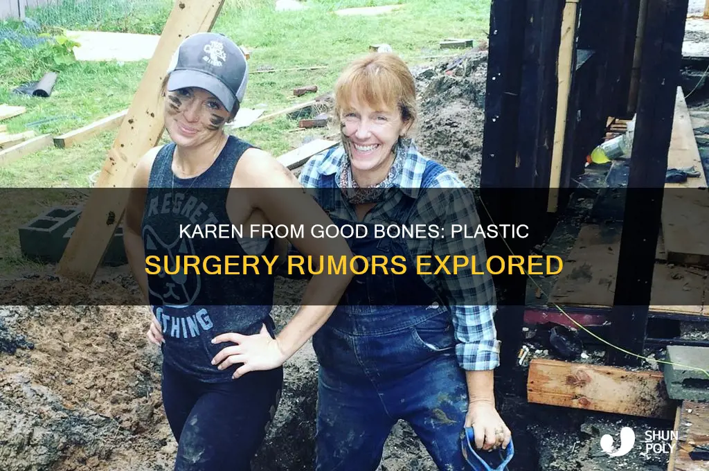 Karen From Good Bones: Plastic Surgery Rumors Explored | ShunPoly