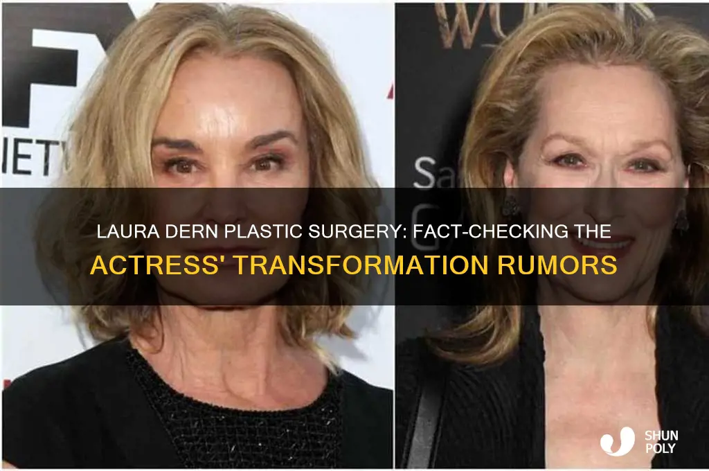 Laura Dern Plastic Surgery: Fact-Checking The Actress' Transformation ...