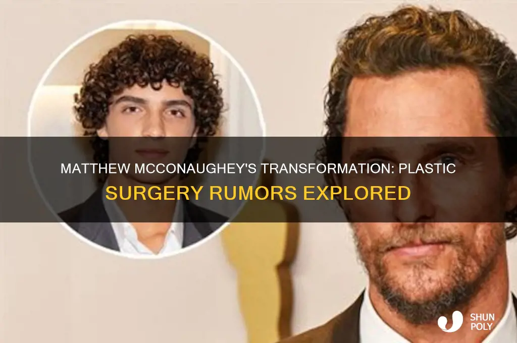 Matthew Mcconaughey's Transformation: Plastic Surgery Rumors Explored ...