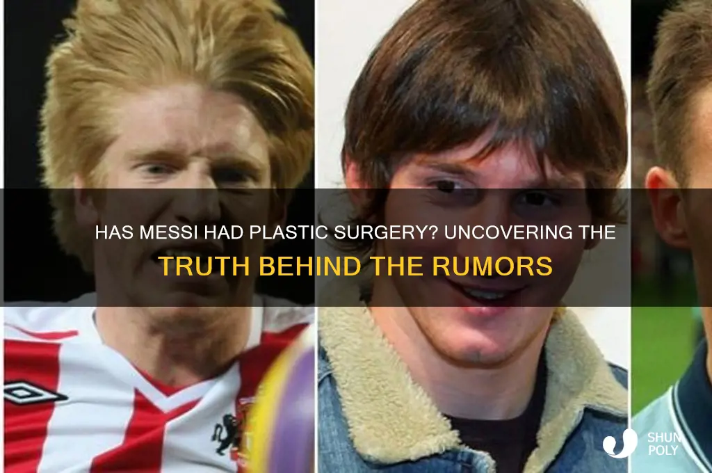 Has Messi Had Plastic Surgery? Uncovering The Truth Behind The Rumors ...