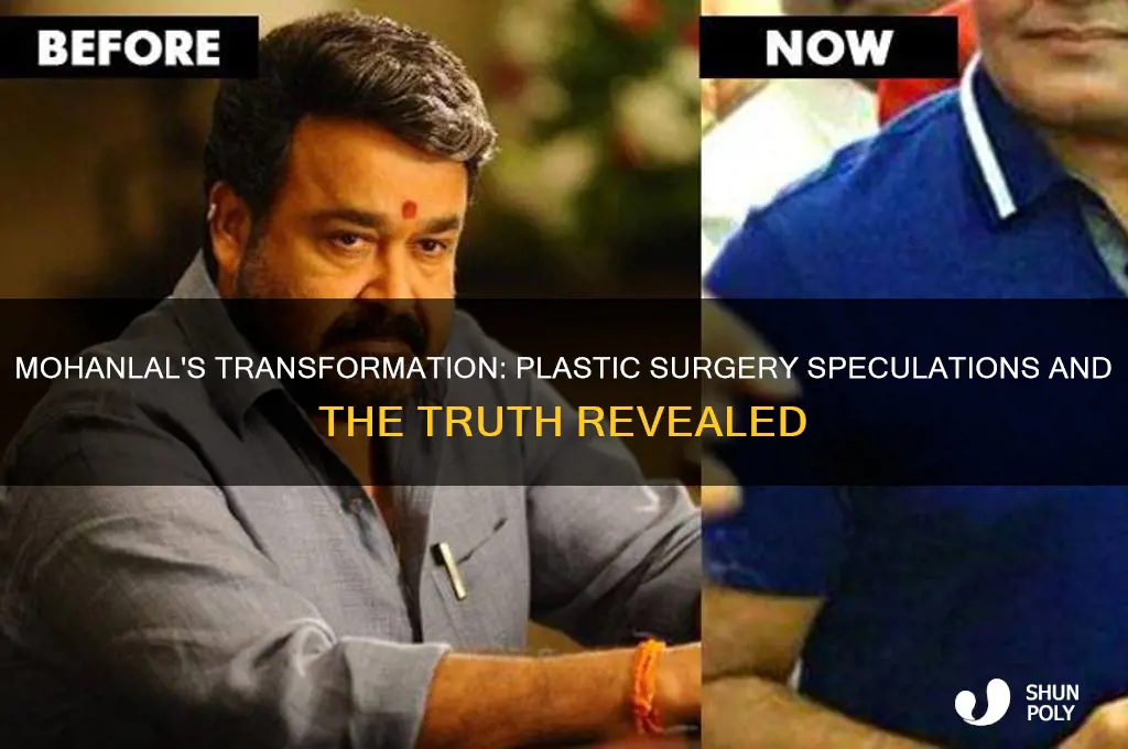 Mohanlal's Transformation: Plastic Surgery Speculations And The Truth ...