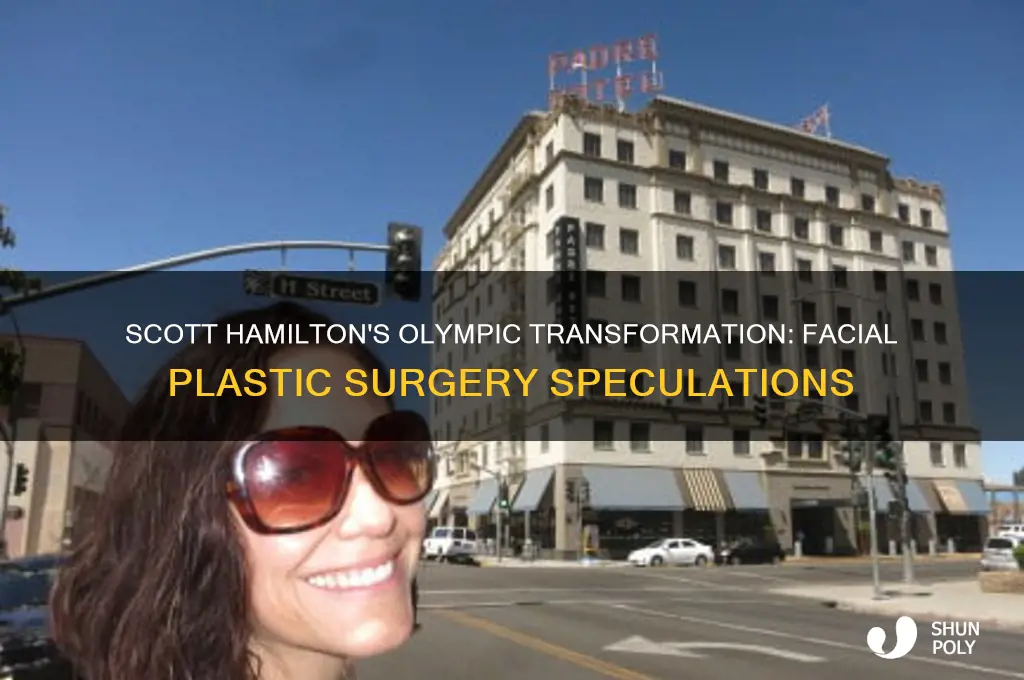 Scott Hamilton's Olympic Transformation: Facial Plastic Surgery ...