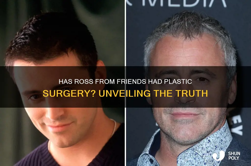 Has Ross From Friends Had Plastic Surgery? Unveiling The Truth | ShunPoly