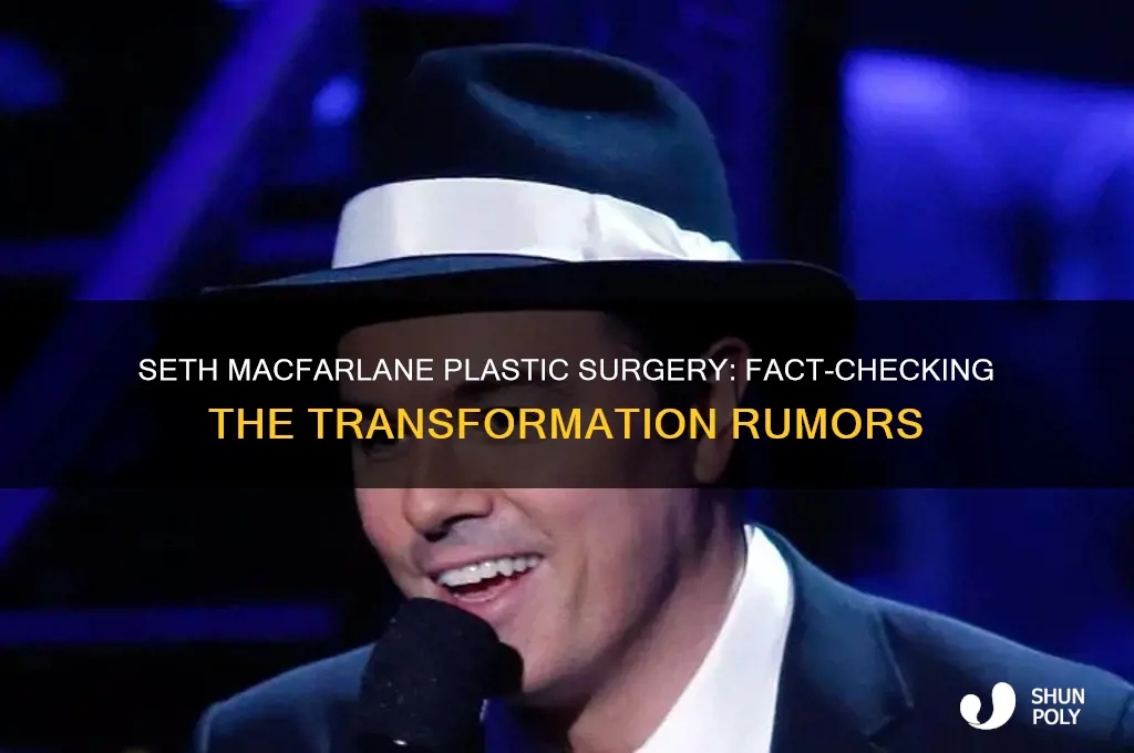 Seth Macfarlane Plastic Surgery: Fact-Checking The Transformation ...