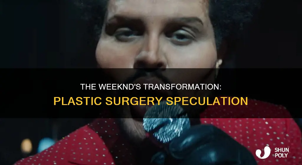 The Weeknd's Transformation: Plastic Surgery Speculation | ShunPoly