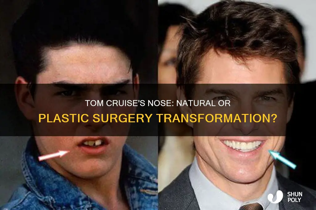 Tom Cruise's Nose: Natural Or Plastic Surgery Transformation? | ShunPoly