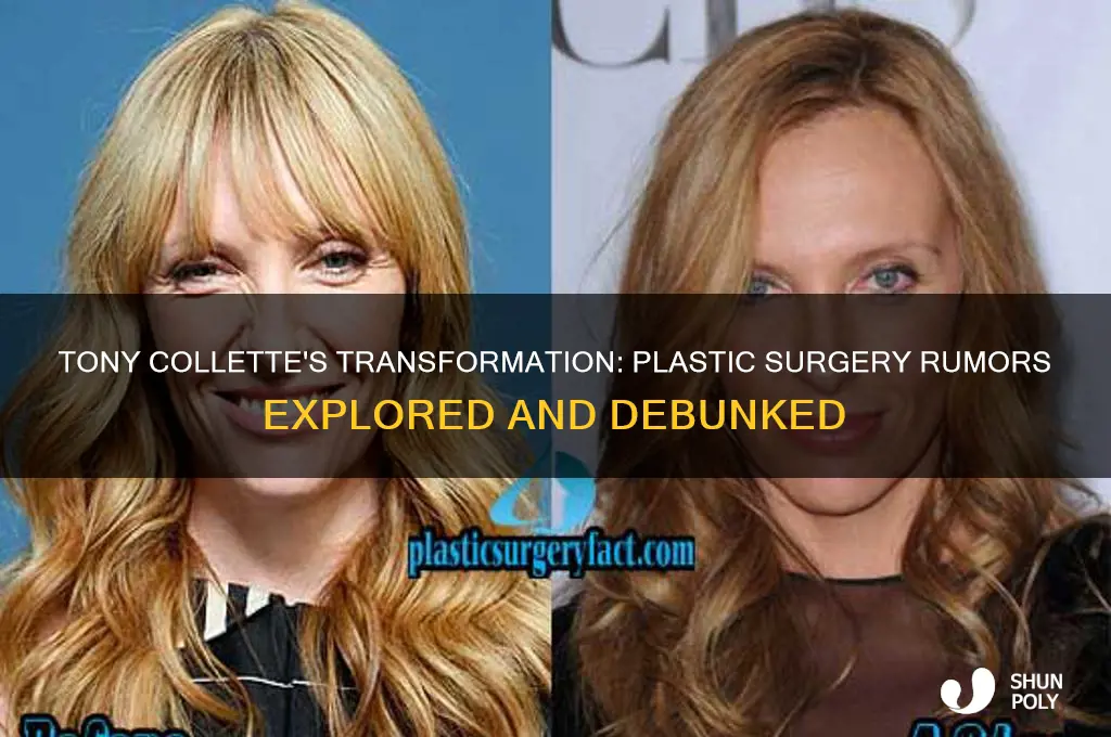 Tony Collette's Transformation: Plastic Surgery Rumors Explored And ...