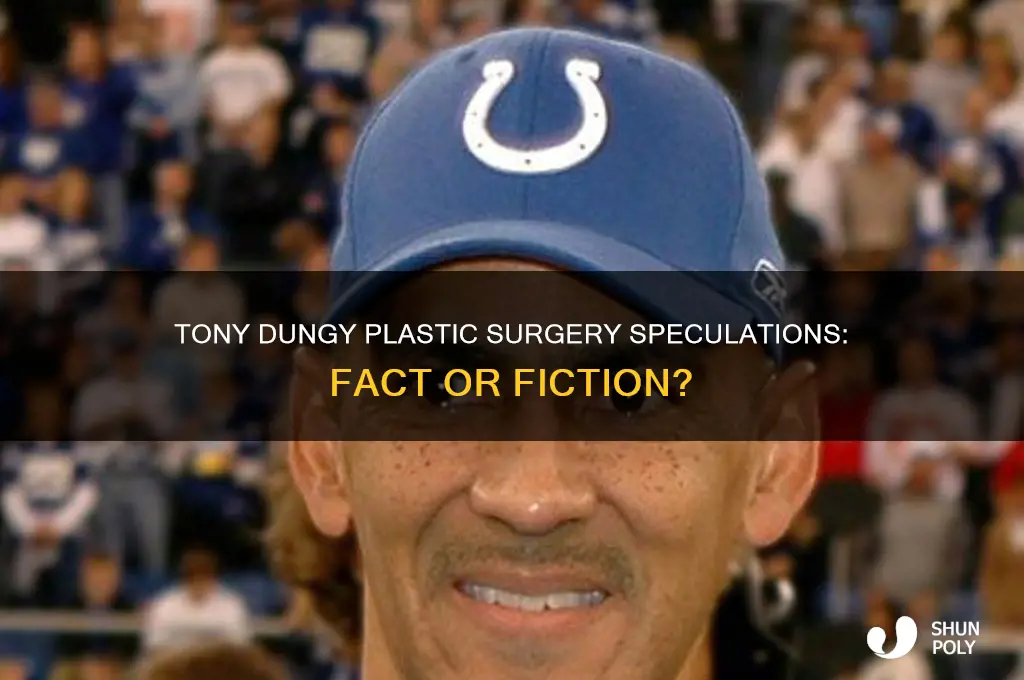 Tony Dungy Plastic Surgery Speculations: Fact Or Fiction? | ShunPoly