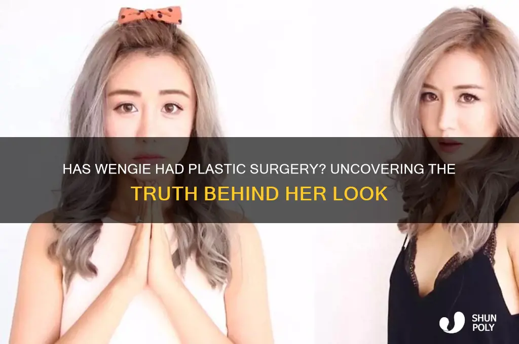 Has Wengie Had Plastic Surgery? Uncovering The Truth Behind Her Look ...