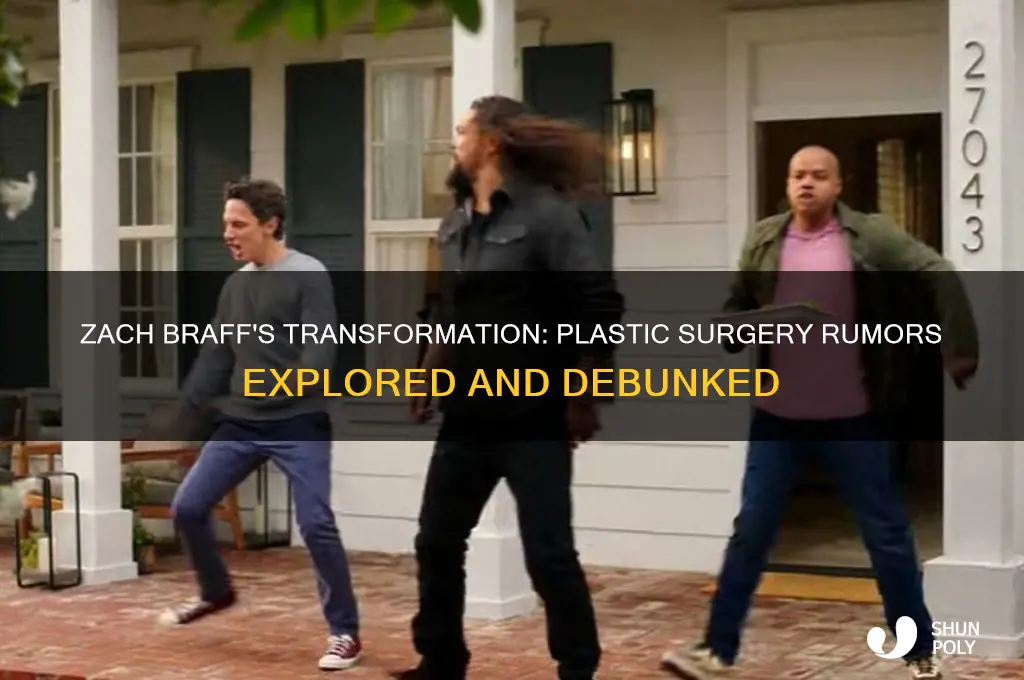 Zach Braff's Transformation: Plastic Surgery Rumors Explored And ...