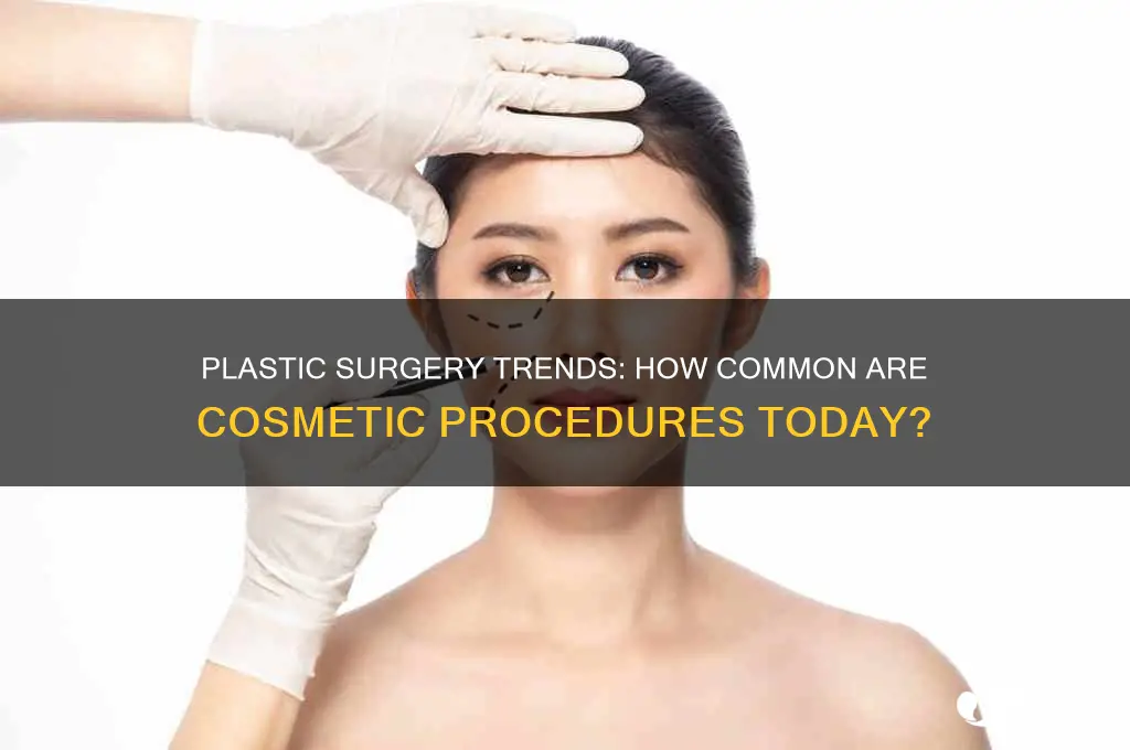 Plastic Surgery Trends: How Common Are Cosmetic Procedures Today ...