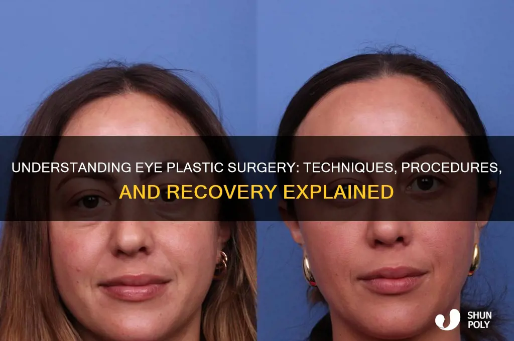 Understanding Eye Plastic Surgery: Techniques, Procedures, And Recovery ...