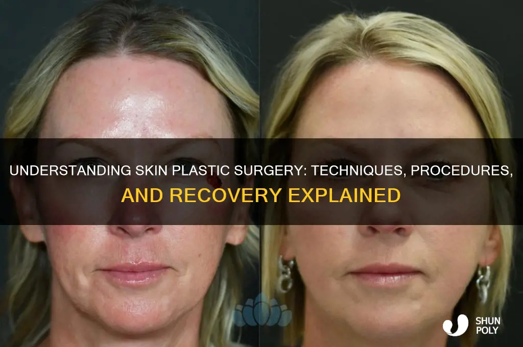 Understanding Skin Plastic Surgery: Techniques, Procedures, And ...