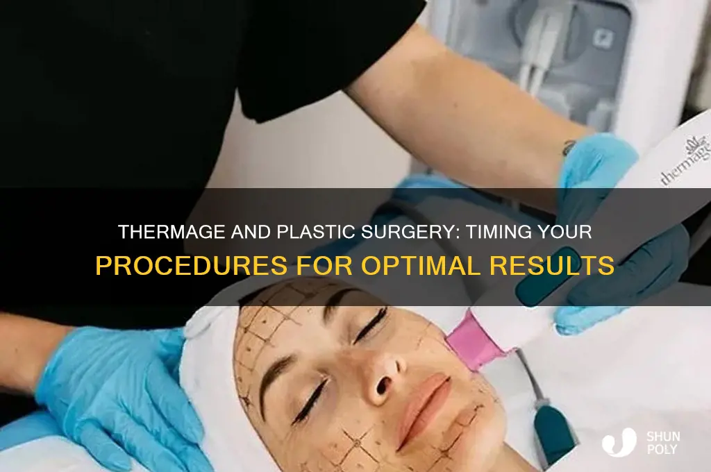 Thermage And Plastic Surgery: Timing Your Procedures For Optimal ...