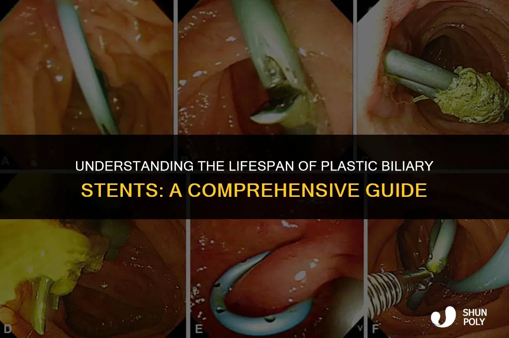 Understanding The Lifespan Of Plastic Biliary Stents: A Comprehensive ...