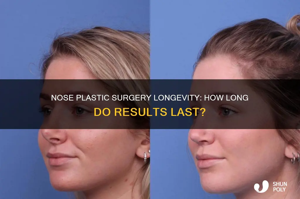 Nose Plastic Surgery Longevity: How Long Do Results Last? | ShunPoly