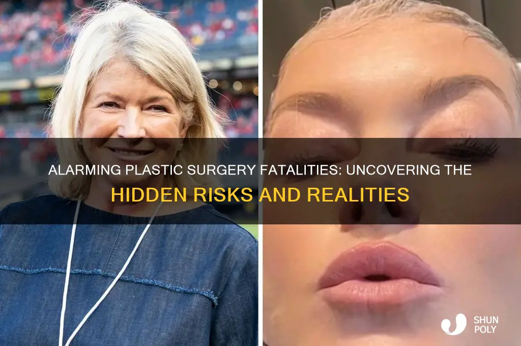 Alarming Plastic Surgery Fatalities: Uncovering The Hidden Risks And ...