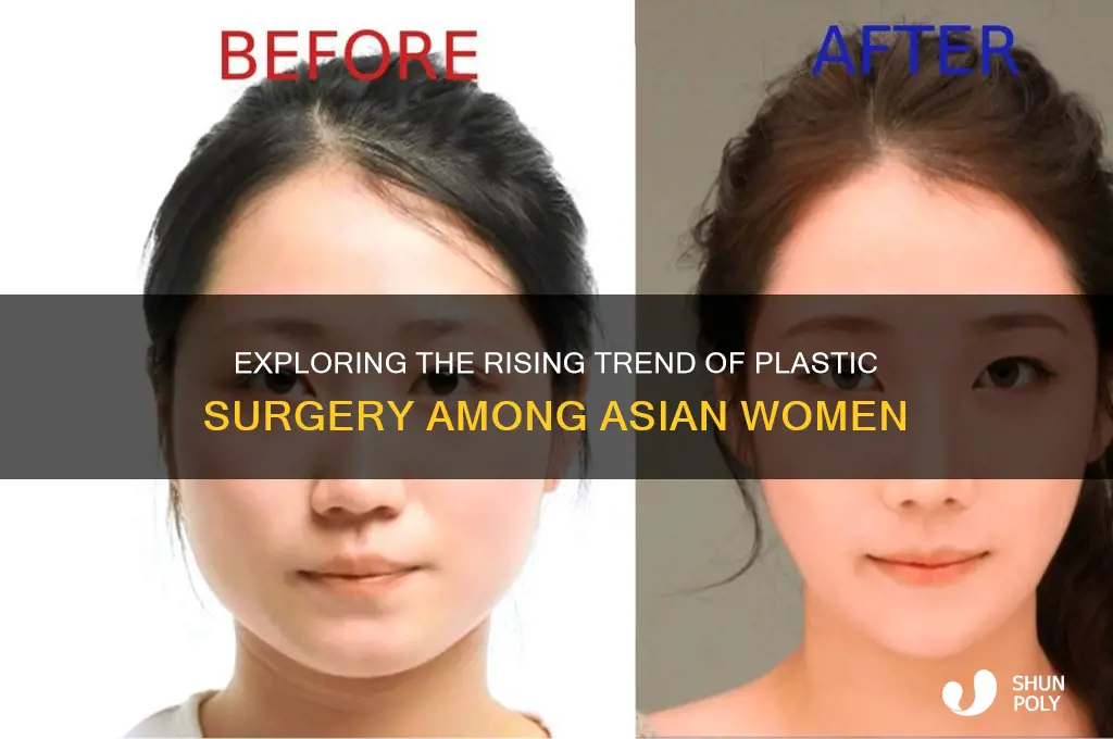 Exploring The Rising Trend Of Plastic Surgery Among Asian Women | ShunPoly
