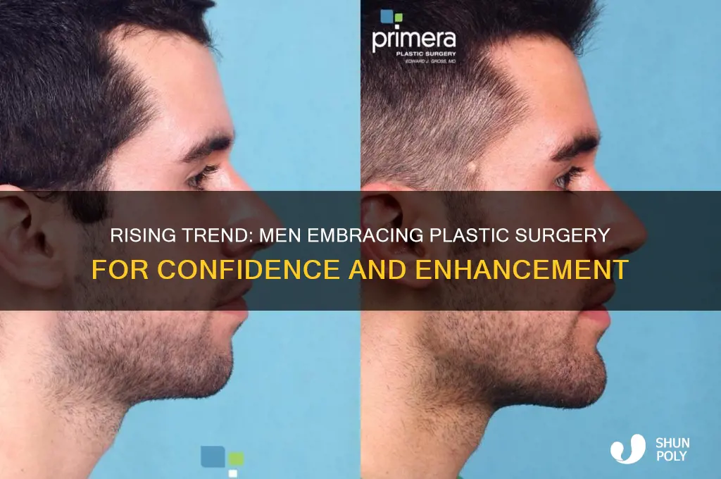 Rising Trend: Men Embracing Plastic Surgery For Confidence And ...