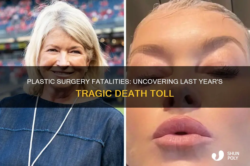 Plastic Surgery Fatalities: Uncovering Last Year's Tragic Death Toll ...