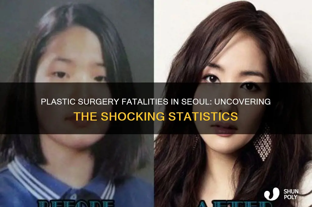 Plastic Surgery Fatalities In Seoul: Uncovering The Shocking Statistics ...