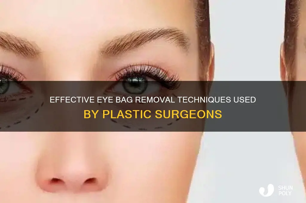 Effective Eye Bag Removal Techniques Used By Plastic Surgeons | ShunPoly