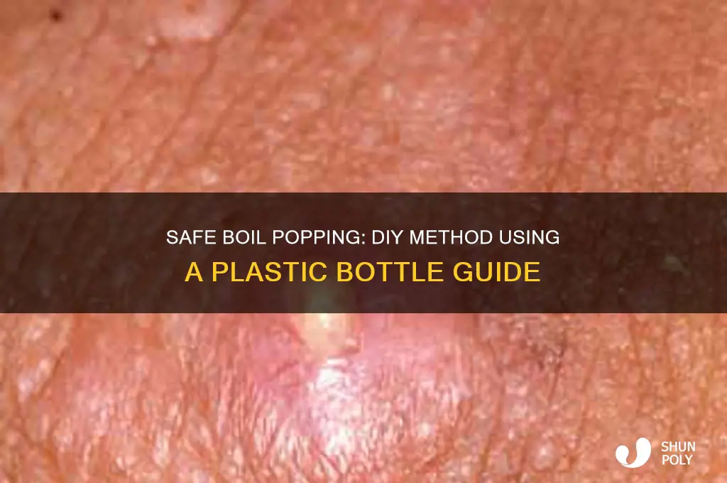Safe Boil Popping: Diy Method Using A Plastic Bottle Guide | ShunPoly