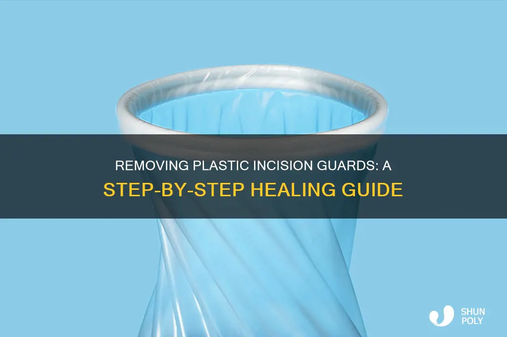 Removing Plastic Incision Guards: A Step-By-Step Healing Guide | ShunPoly