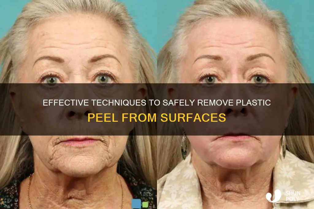 Effective Techniques To Safely Remove Plastic Peel From Surfaces | ShunPoly