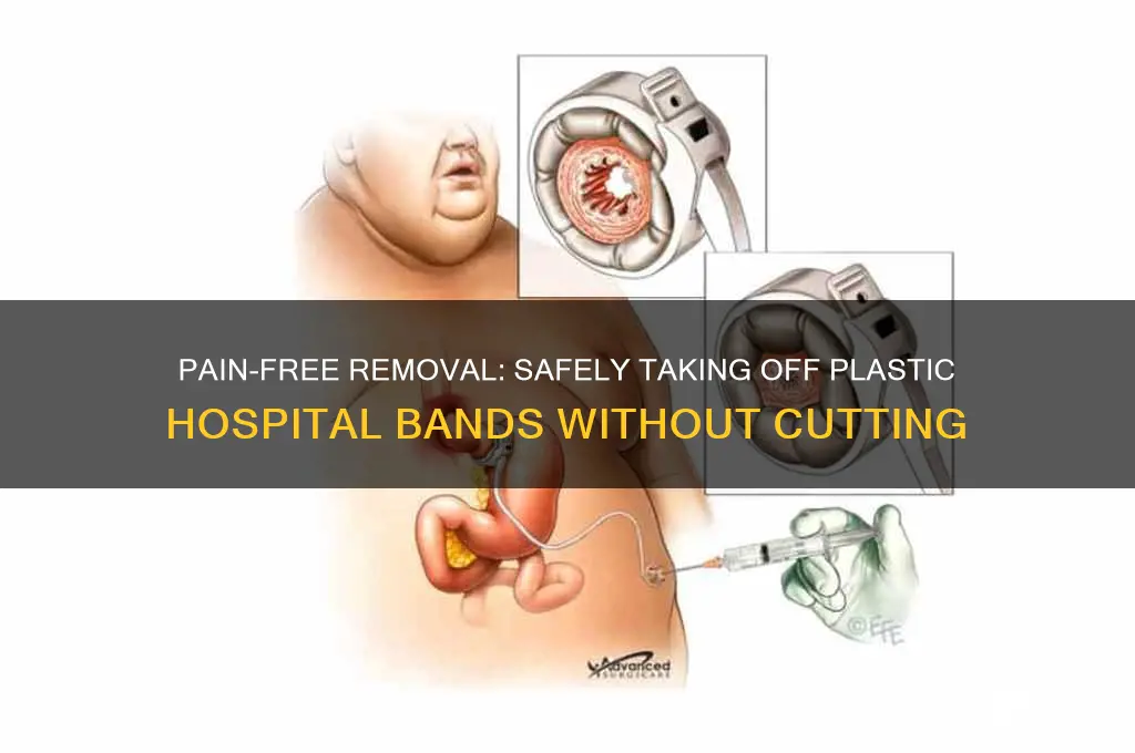 Pain-Free Removal: Safely Taking Off Plastic Hospital Bands Without ...
