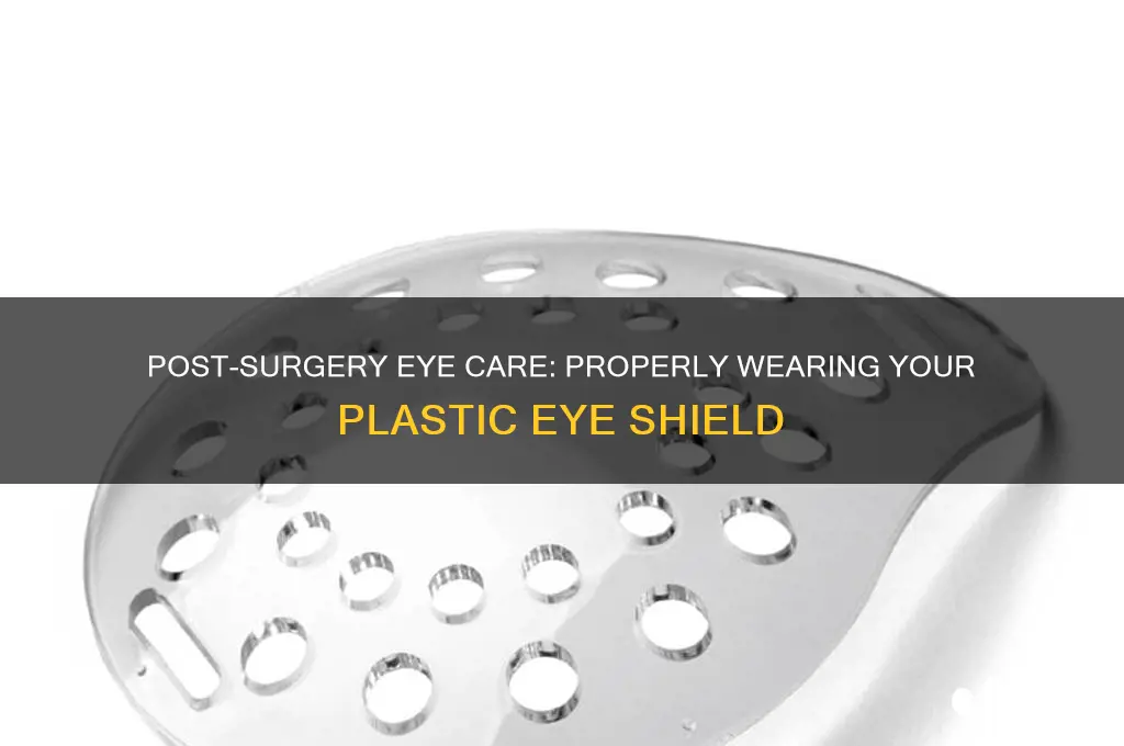 Post-Surgery Eye Care: Properly Wearing Your Plastic Eye Shield | ShunPoly