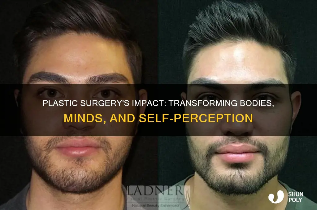 Plastic Surgery's Impact: Transforming Bodies, Minds, And Self ...