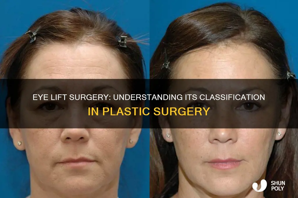 Eye Lift Surgery: Understanding Its Classification In Plastic Surgery ...