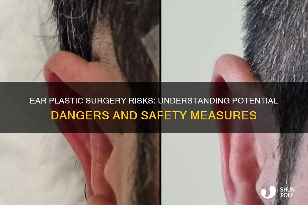 Ear Plastic Surgery Risks: Understanding Potential Dangers And Safety ...