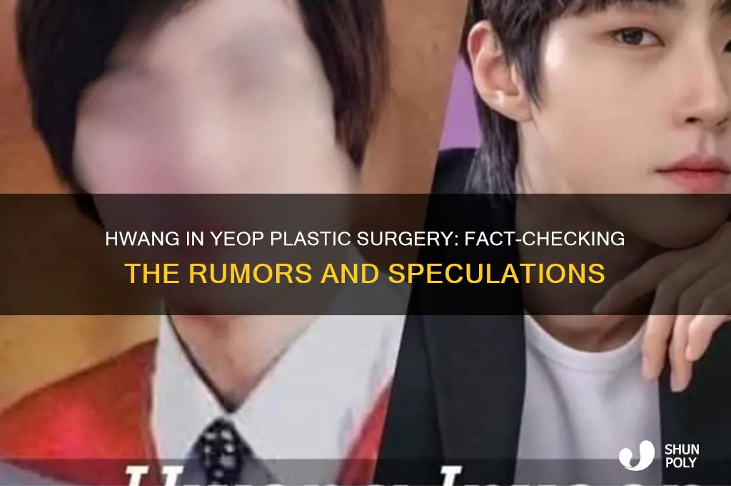 Hwang In Yeop Plastic Surgery: Fact-Checking The Rumors And ...