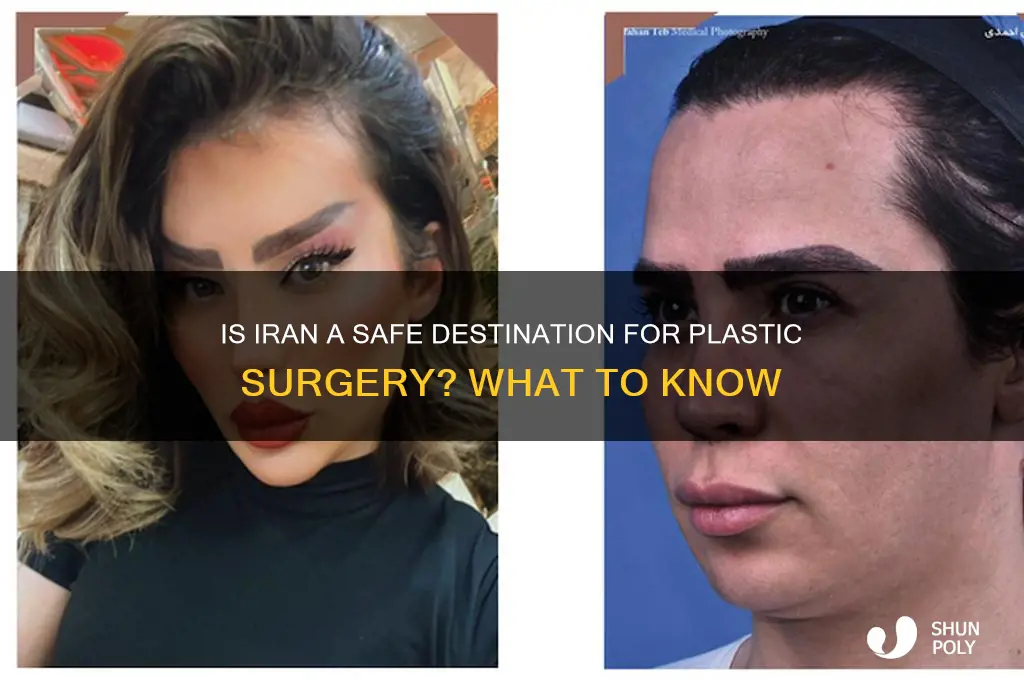 Is Iran A Safe Destination For Plastic Surgery? What To Know | ShunPoly