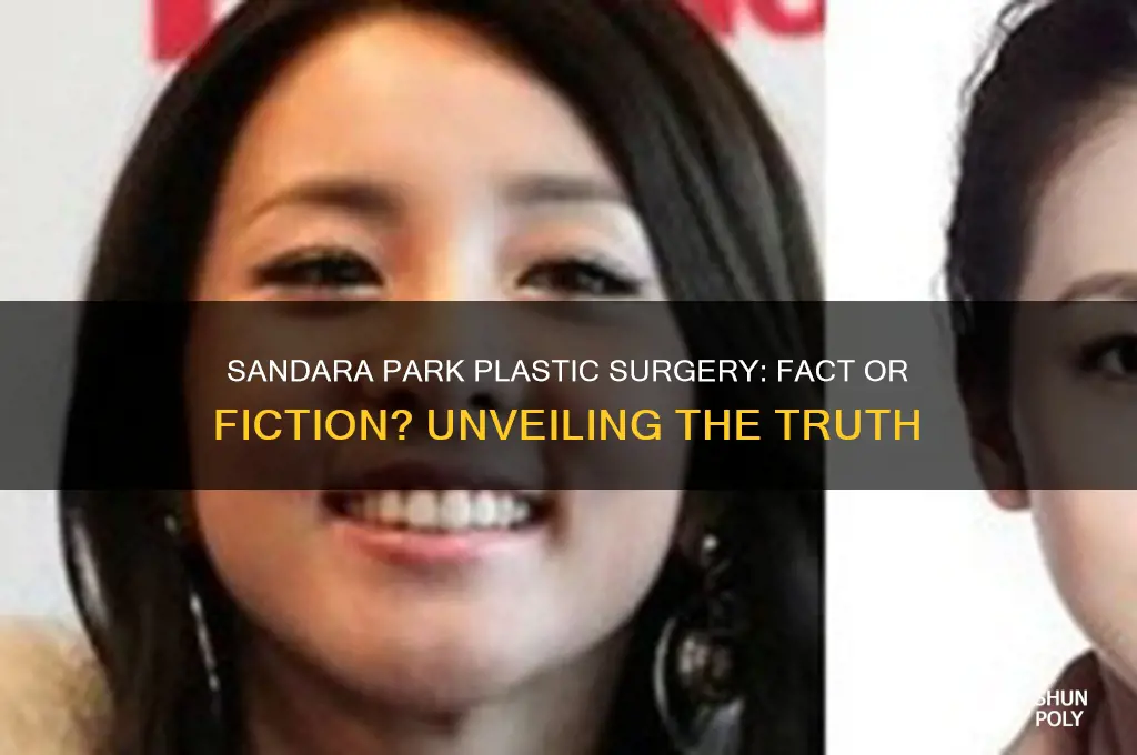 Sandara Park Plastic Surgery: Fact Or Fiction? Unveiling The Truth ...